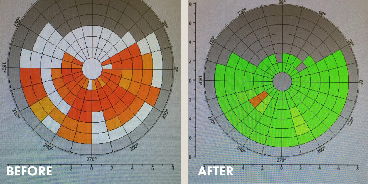 Ocular Surface Disease Tyler TX | Today's Vision, Tyler
